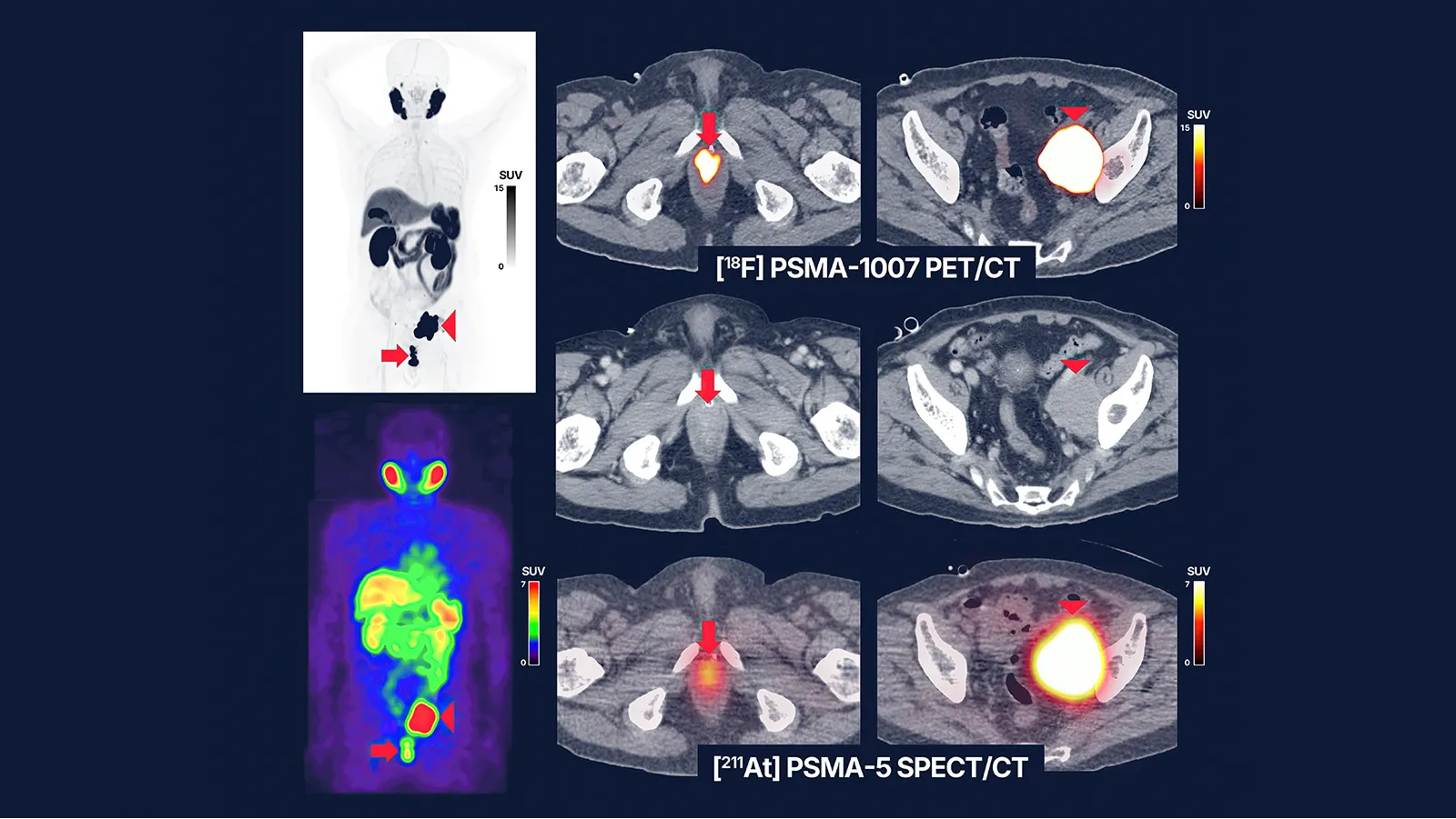 PIPELINE | Alpha Fusion Inc. | Alpha Fusion 株式会社